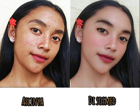 BEBAS JERAWAT/BEKAS JERAWAT ATAUPUN BOPENG BEKAS CACAR AIR. LIHAT C...